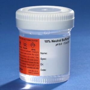 Buffered Formalin, 10%, 30mL Prefilled Containers - 50/Box